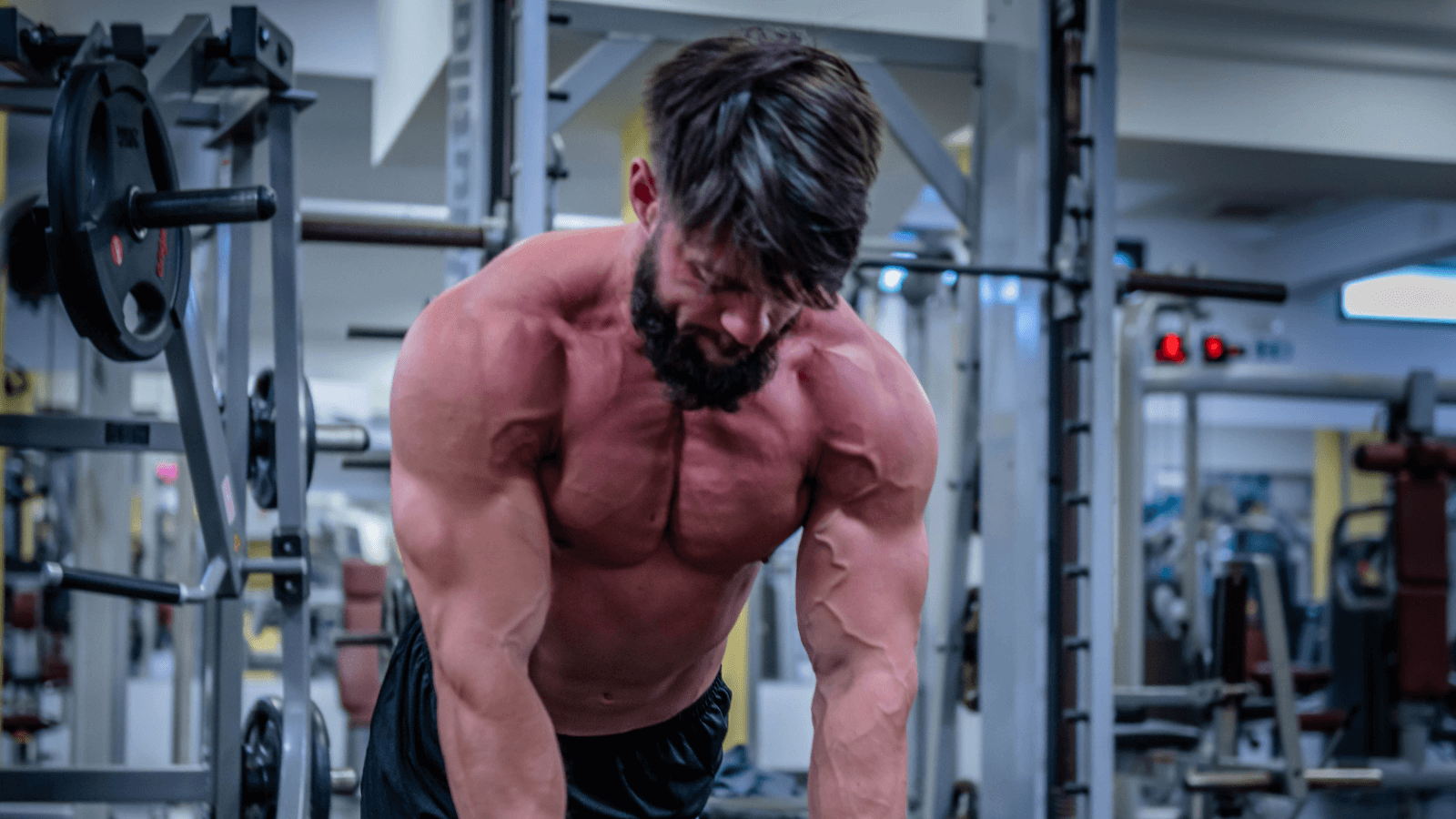 Saw Palmetto : cheveux, testostérone, prostate, notre avis